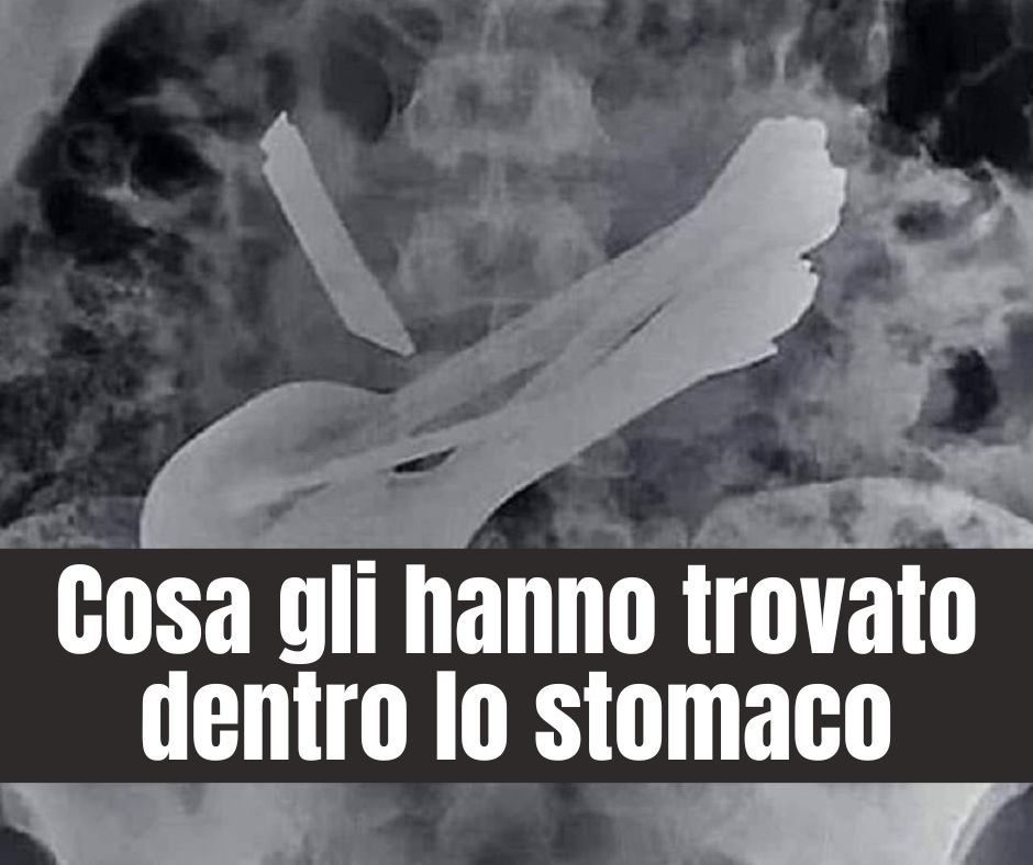 Margaret avverte dolori lancinanti allo stomaco: l’esito della tac è ...